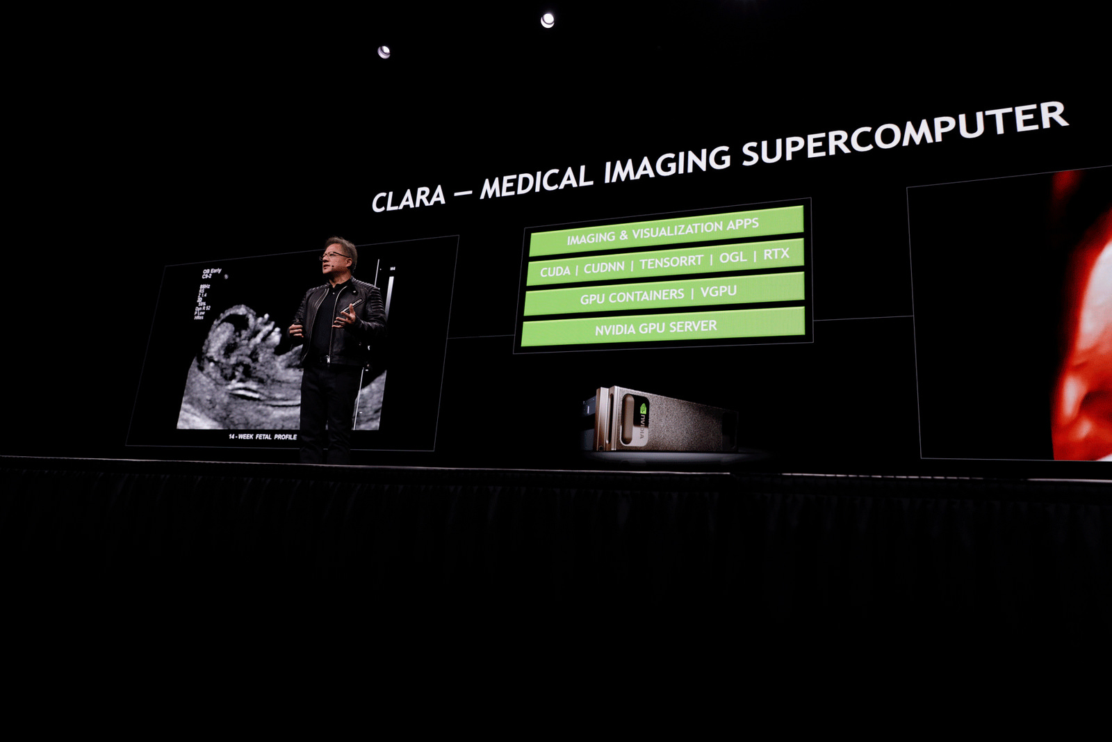 NVIDIA Clara Platform to Usher in Next Wave of Medical Instruments ...